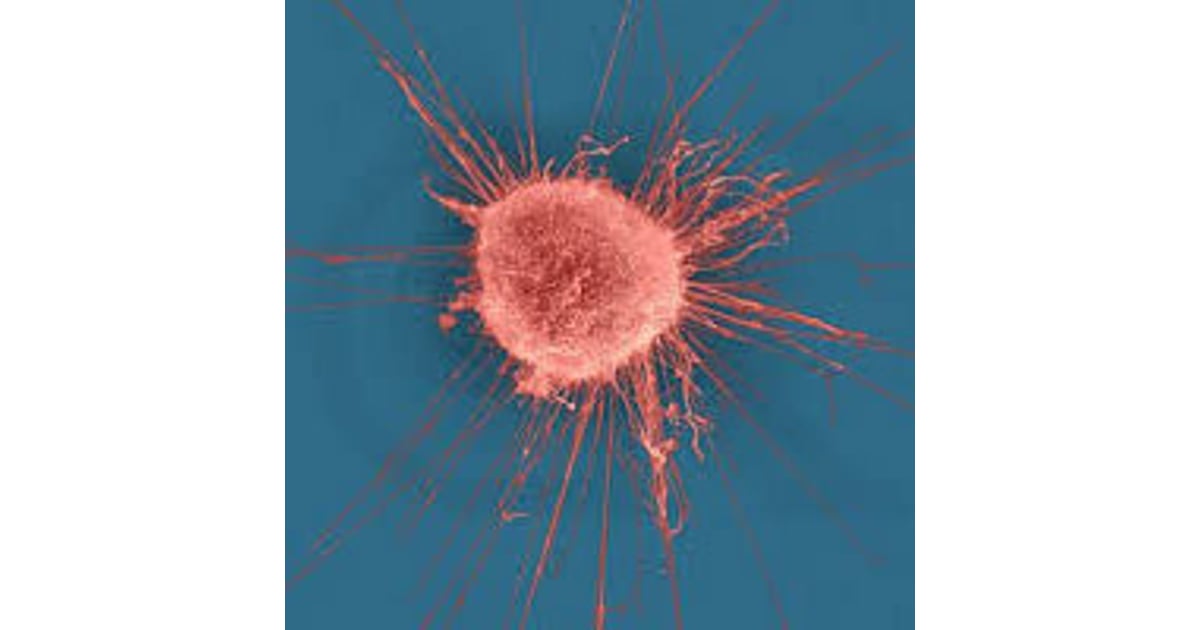 Helios Homeopathy - Shop - Carcinosin