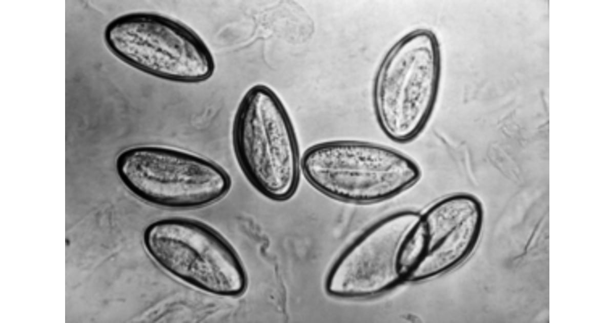 Helios Homeopathy - Shop - Oxyuris