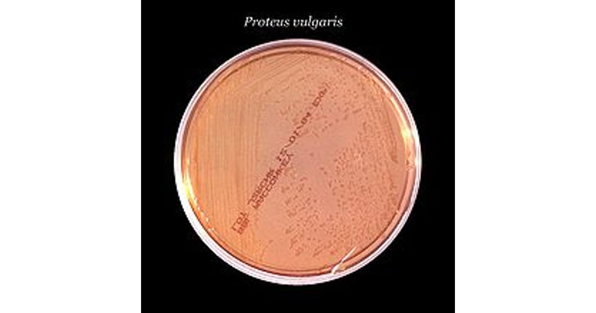 Helios Homeopathy - Shop - Proteus Vulgaris