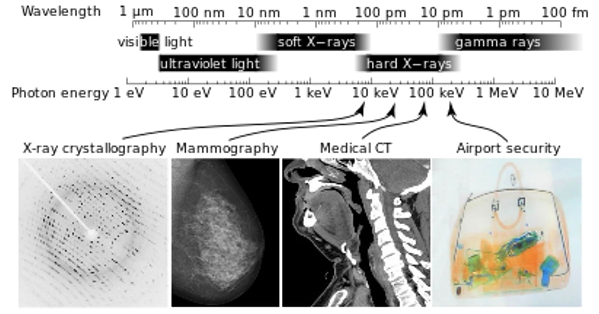 Helios Homeopathy - Shop - X-ray